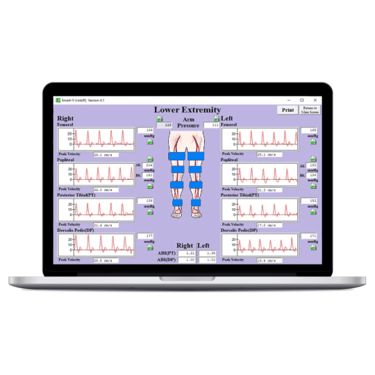 Products - Vascular and Dopplers